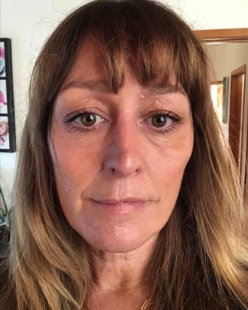 Skin rejuvenation treatments and dermal fillers can dramatically ...