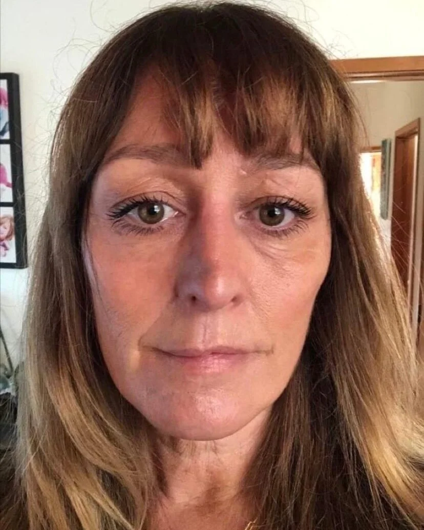 Skin rejuvenation treatments and dermal fillers can dramatically ...