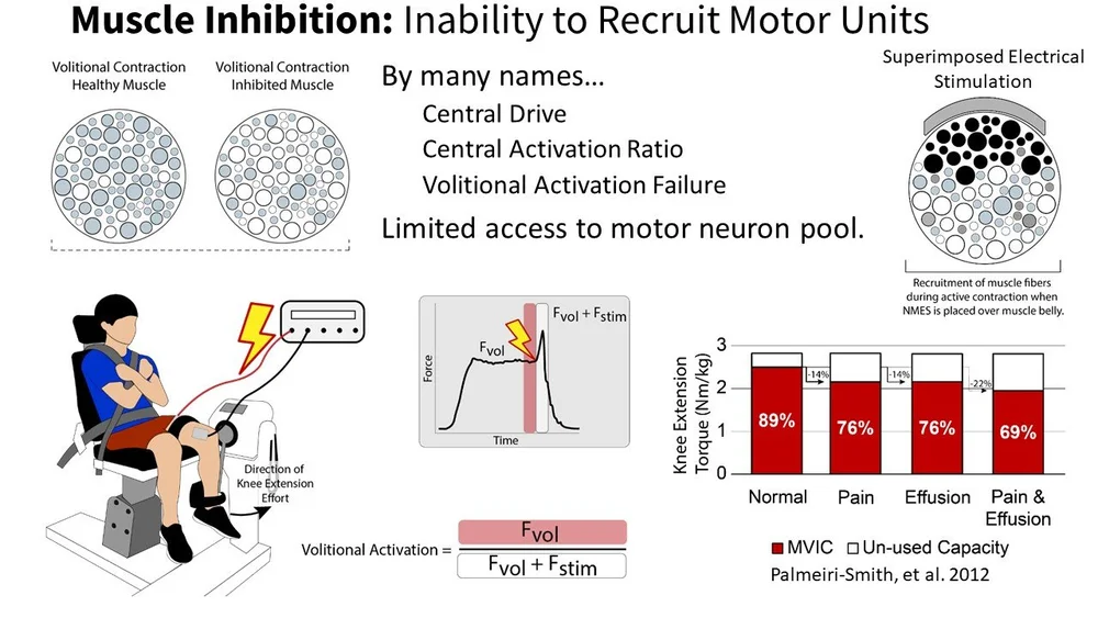 Rewiring Recovery: Treating Muscle Inhibition After Knee Injury — LIVE4 ...
