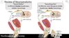 Rewiring Recovery: Treating Muscle Inhibition After Knee Injury — LIVE4 ...