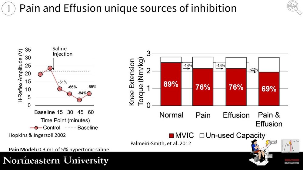 Rewiring Recovery: Treating Muscle Inhibition After Knee Injury — LIVE4 ...