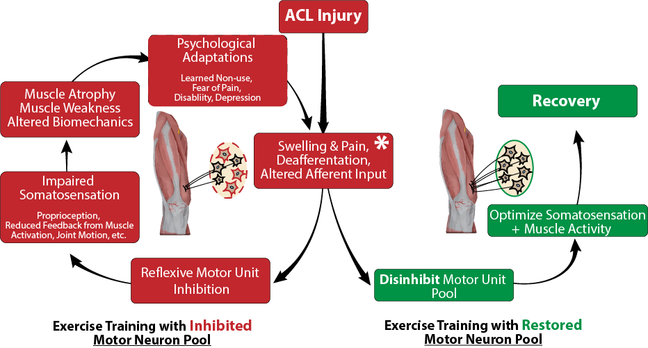 How Common Is Muscle Inhibition After ACL Injury LIVE4 Sports