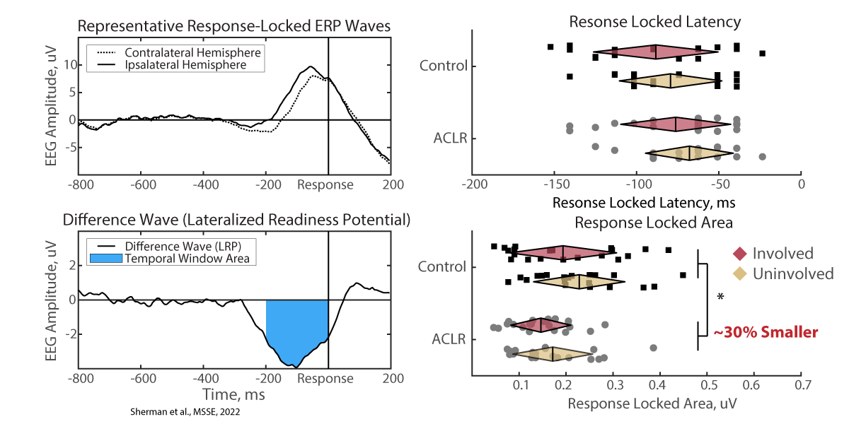 Motor Planning and Response Selection after Anterior Cruciate Ligament ...