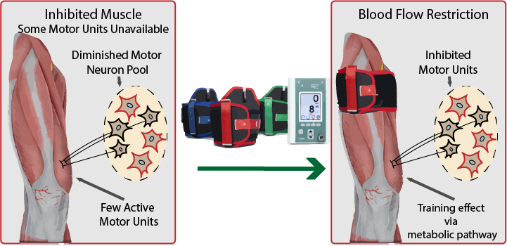 Blood Flow Restriction User Guide — LIVE4 Sports Physical Therapy ...