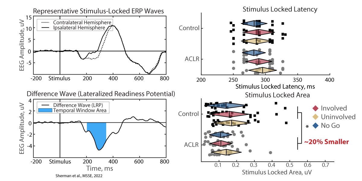 Motor Planning and Response Selection after Anterior Cruciate Ligament ...