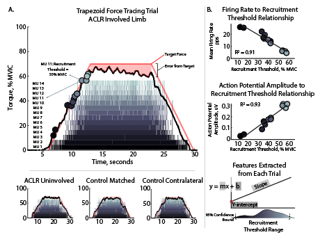 Neural drive and motor unit characteristics after ACLR: Implications ...