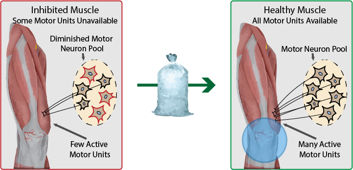 Cryotherapy User Guide — LIVE4 Sports Physical Therapy & Wellness Advising
