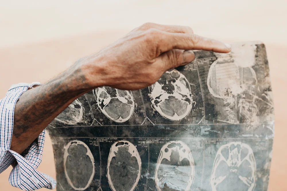 Linn Let Arkar — Portside Review