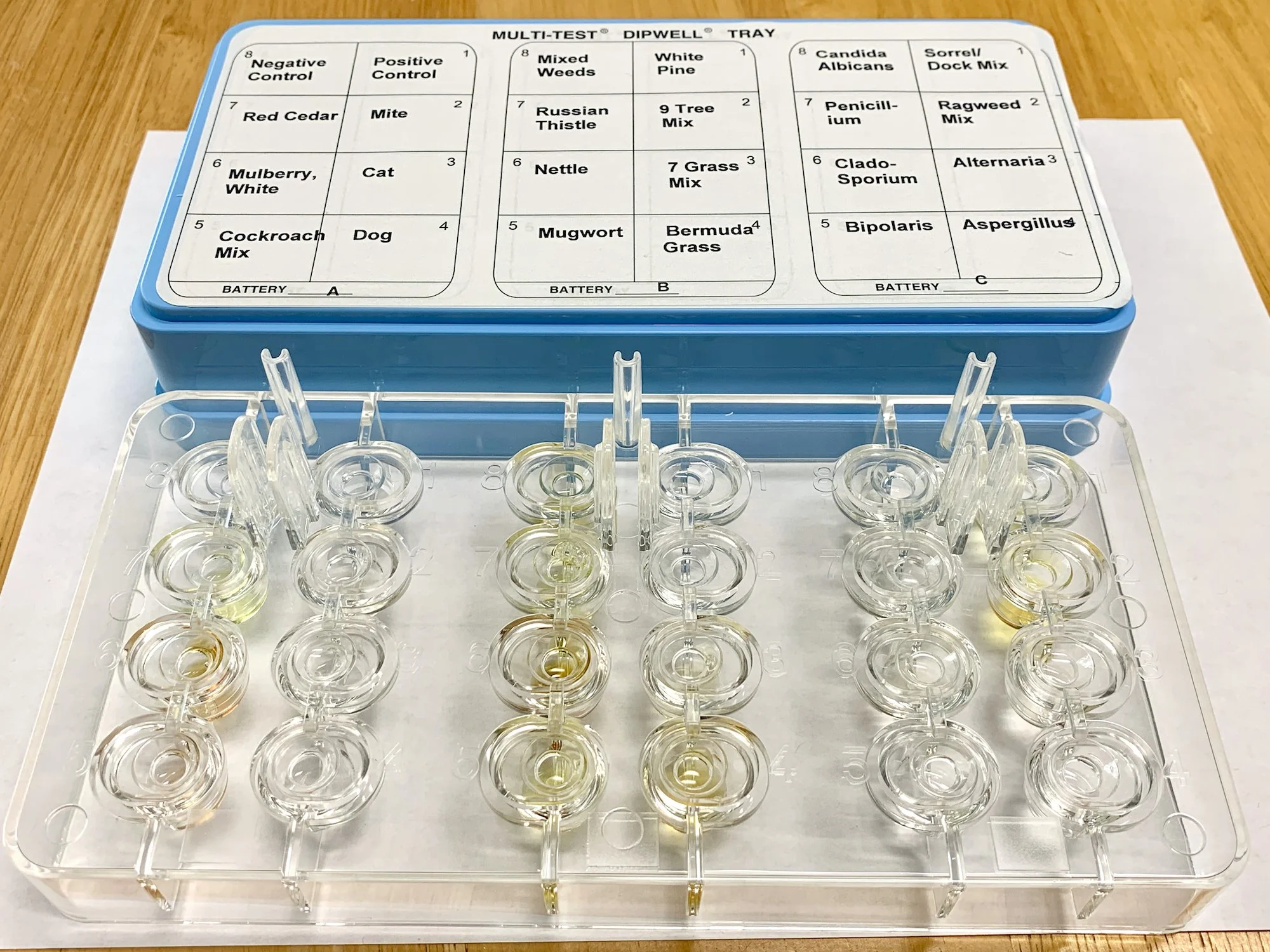 Allergy Testing — Beyond Primary Care