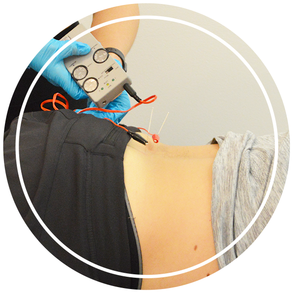 Dry Needling — FIXXED