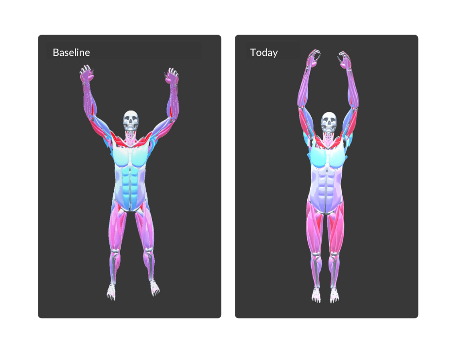 Sports Movement Assessment | Body Scan Machine for Athletes — Kinotek
