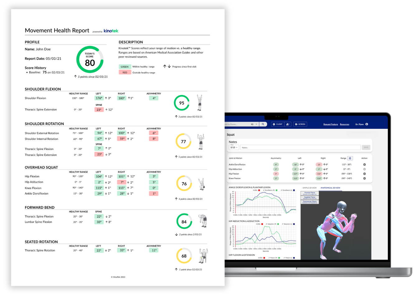 Download Sample Report — Kinotek