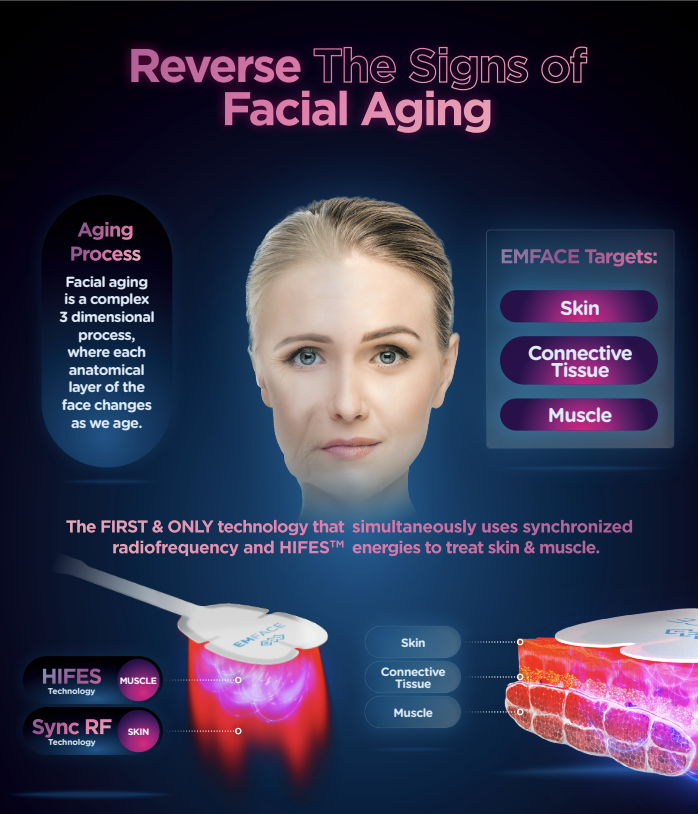 EMFACE — UPGRADE Performance Institute