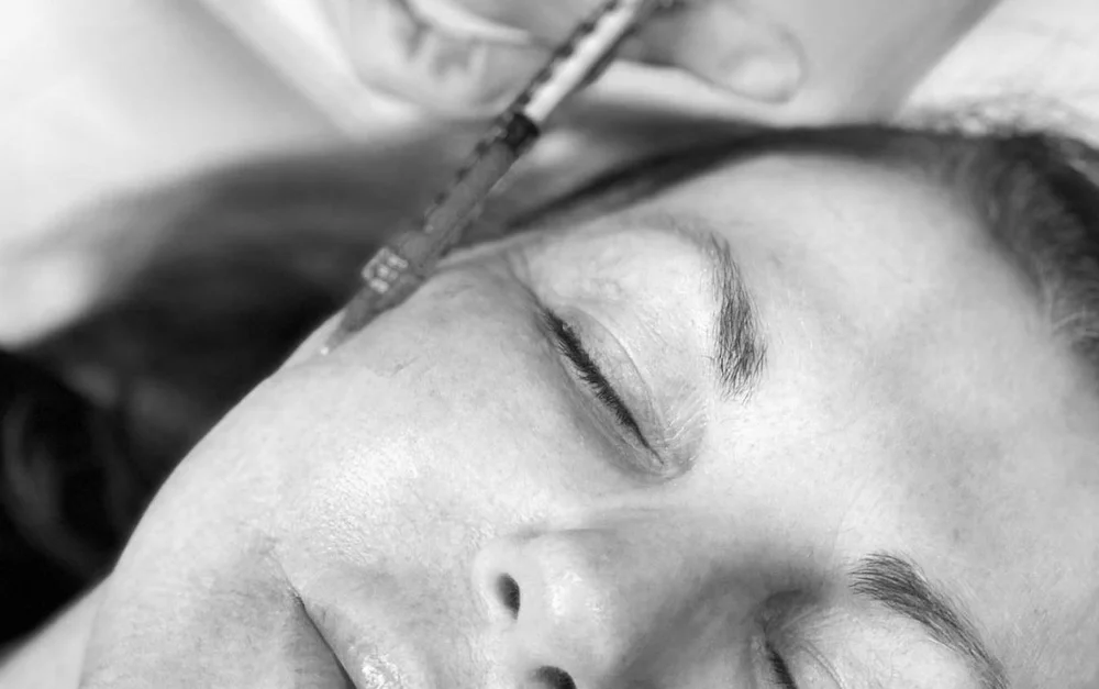 Emcyte PurePRP Facial & Hair Restoration — JBH Aesthetics Camden