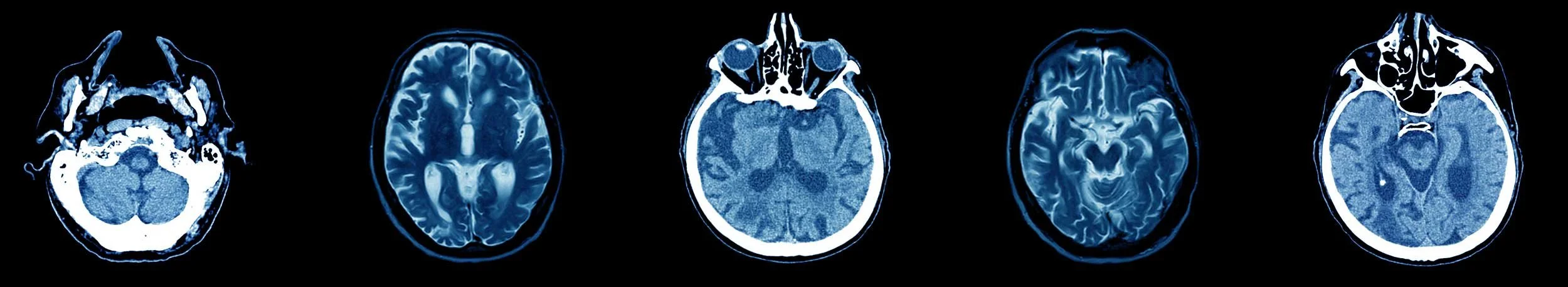 Contact Neurovascular Centre