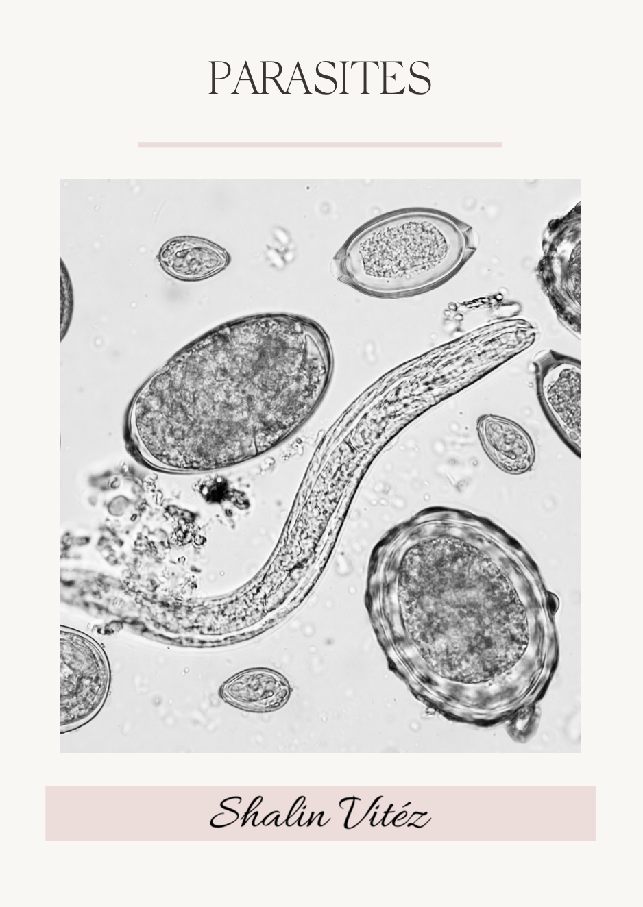 Parasites: A Hidden Cause of Weight Gain — Shalin Dominique