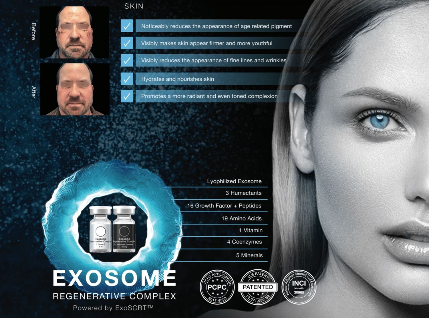 Exosomes - A Breakthrough in Regenerative Aesthetics — Rejuve Medspa ...