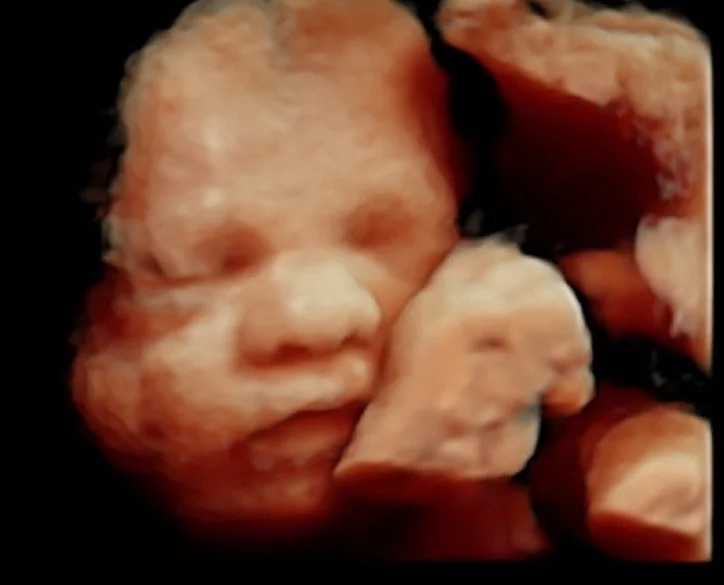 Best Time for a 4D Scan: Week-by-Week Guide — Meet the Baby Ultrasound ...