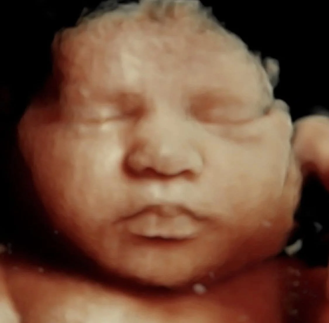 Baby Scans Warrington | Gender Reveal Scans | Meet the Baby