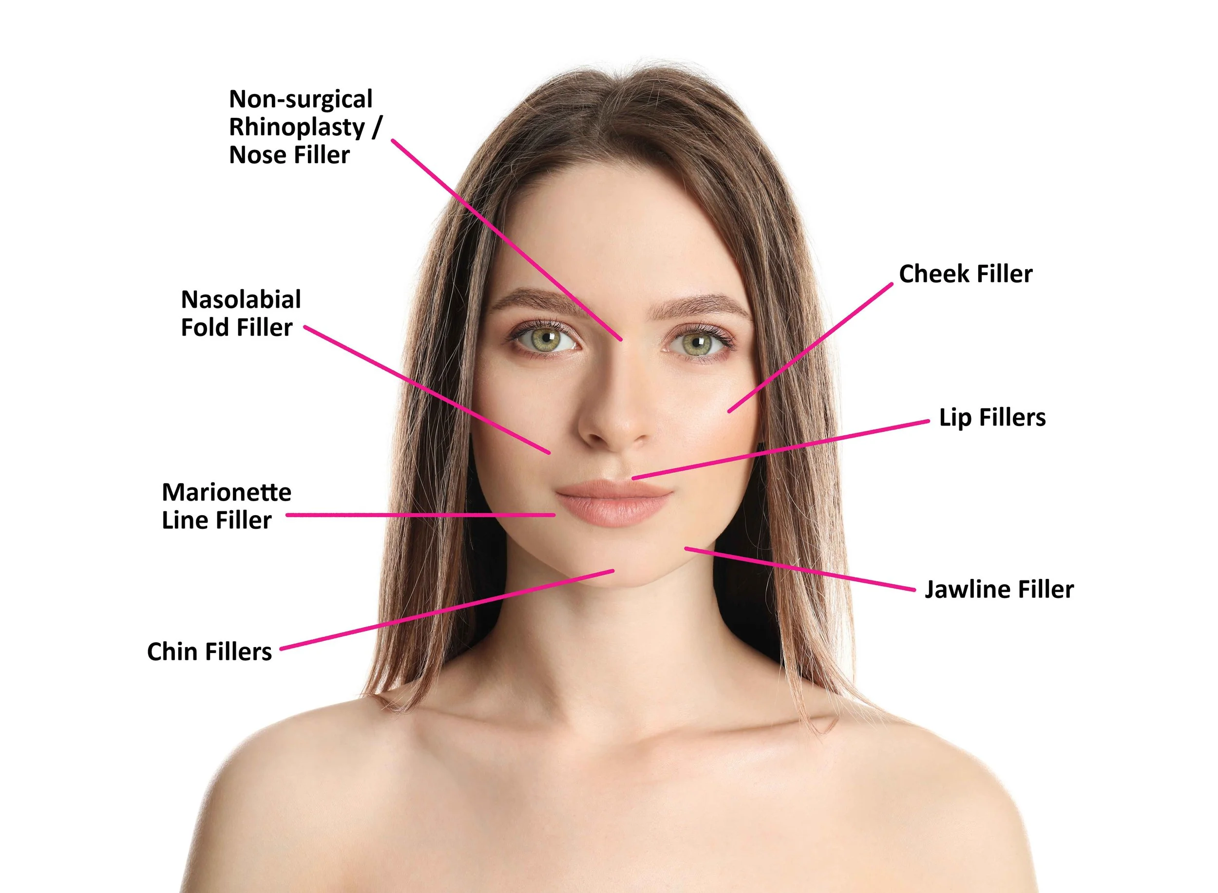 Lip Fillers & Juvederm in Richmond Hill | Cheek Fillers | Valespring