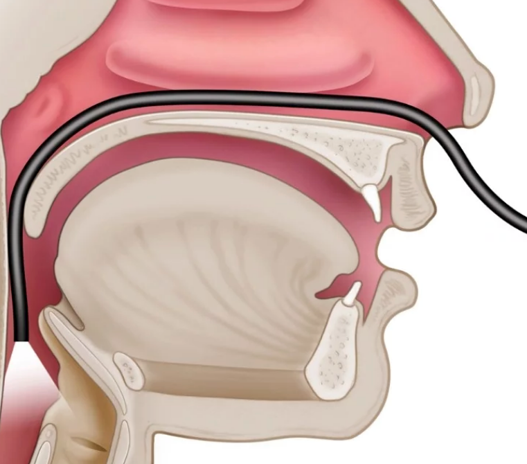 Mobile FEES — PJW Speech and Language Therapy