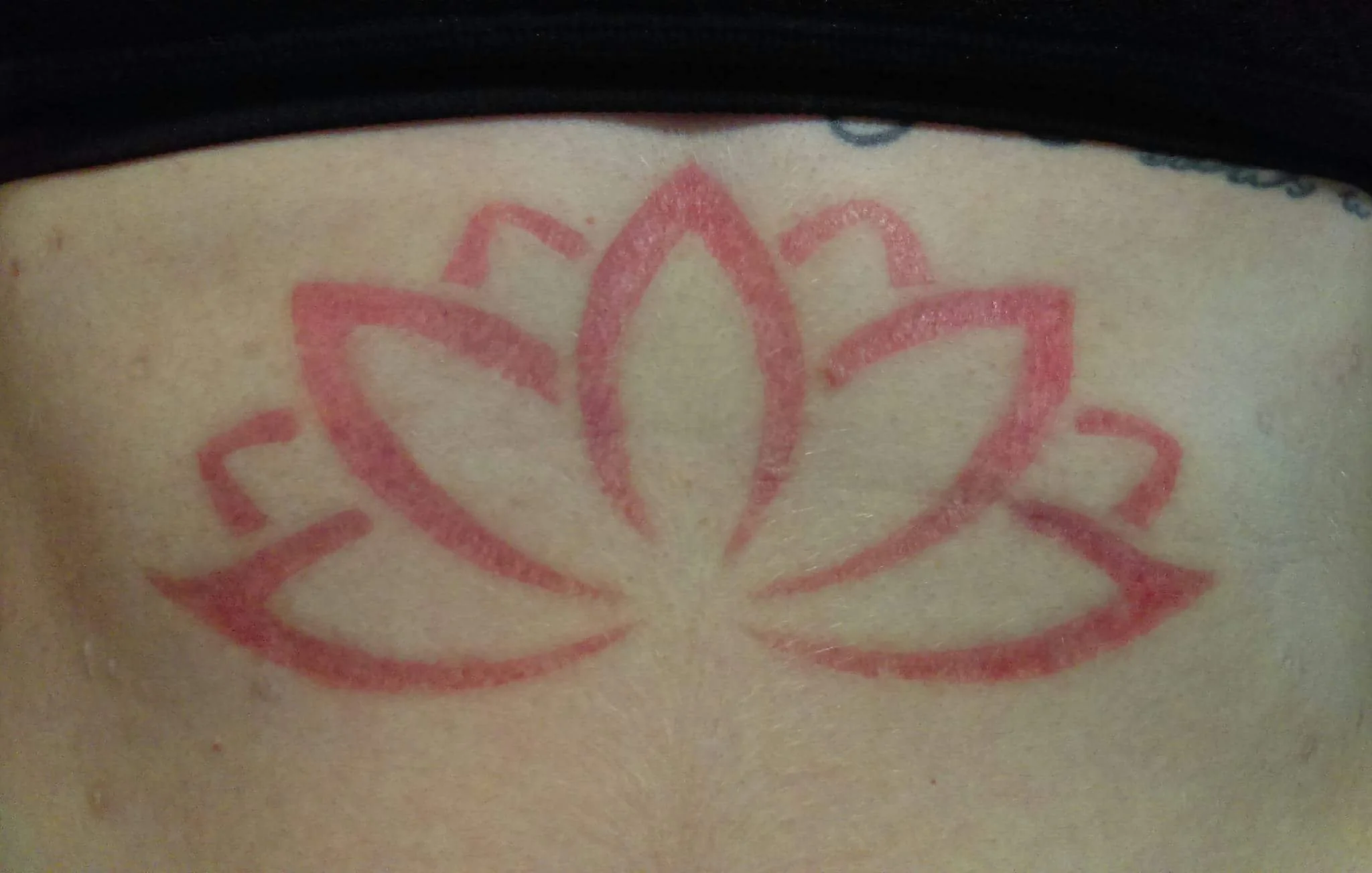 Scarification Aftercare — Artifex - Tattoos, Body Piercings, & Fine Jewelry