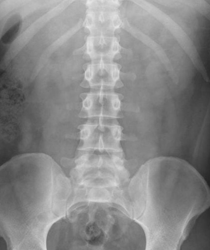 How Chiropractic Has Helped Me - Part 1 - Evolve Chiropractic