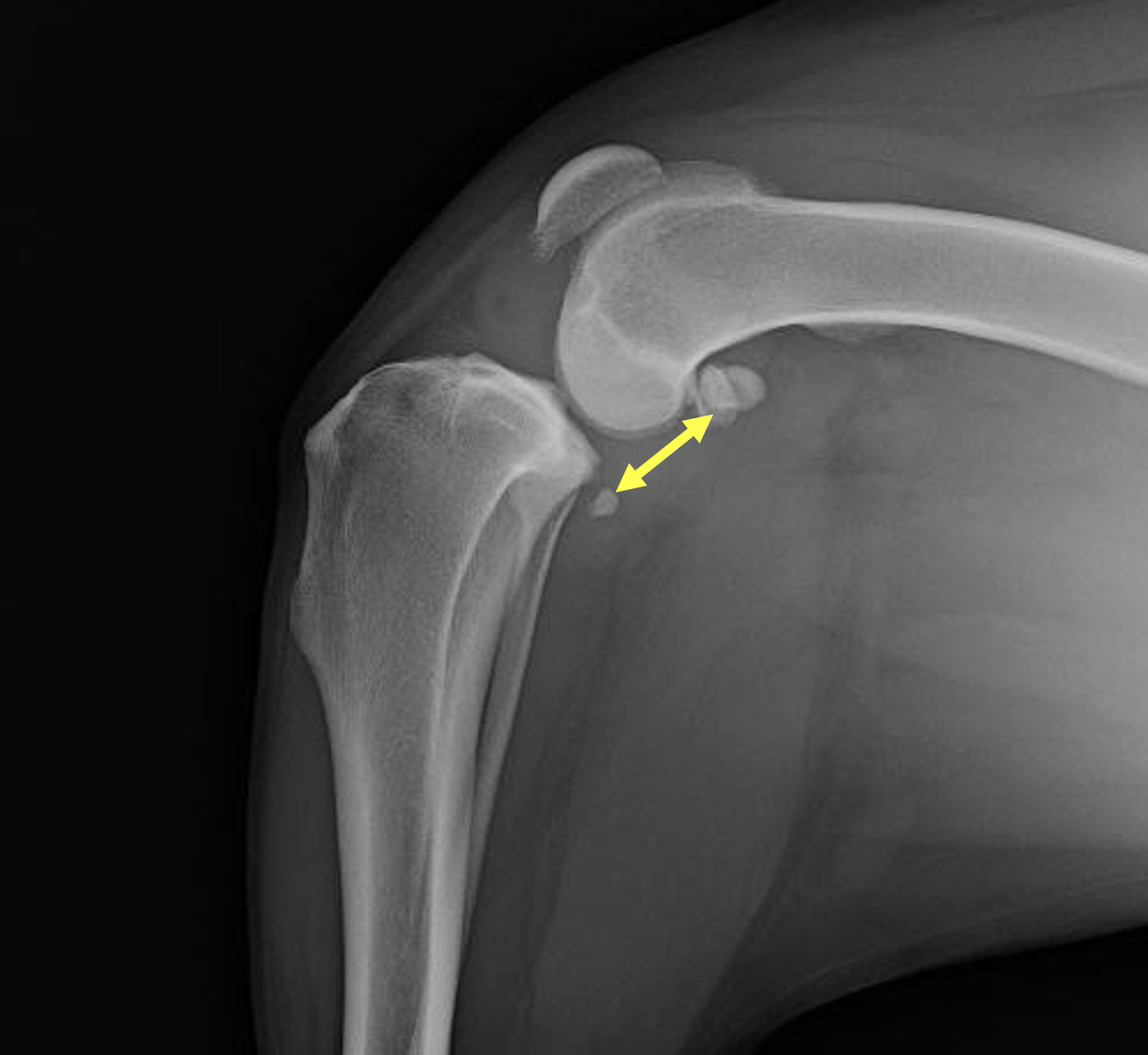 Radiographic Signs of CCL disease — VetSurgInfo