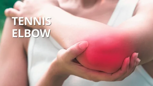 Tennis Elbow: Causes, Symptoms, and Effective Management Strategies ...