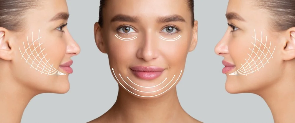 Threads to Lift Face Treatment Bali - Reduce Swelling