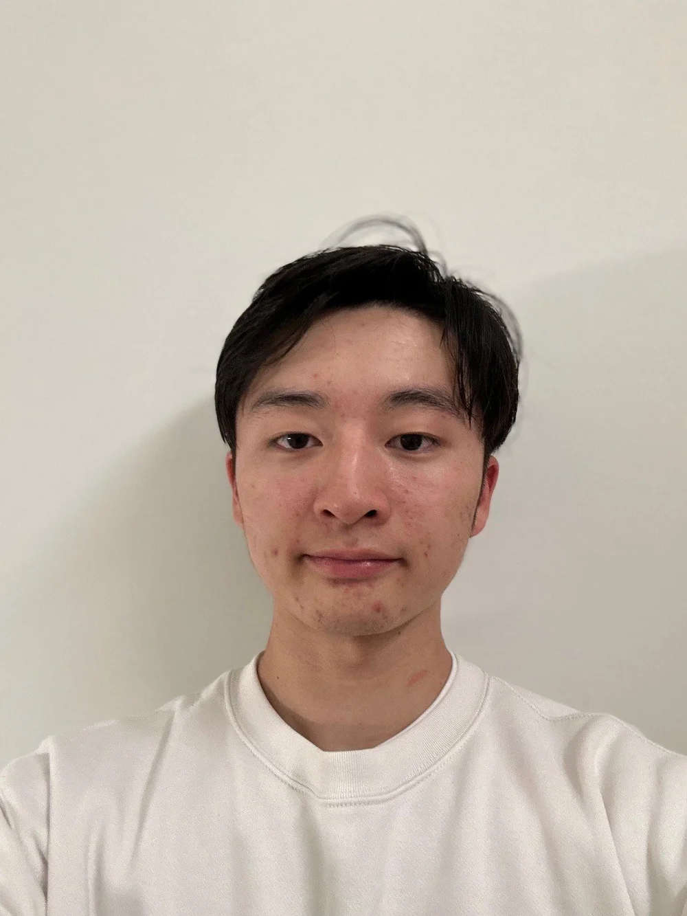 TEAM — Yoshihara Lab at The Lundquist Institute/UCLA