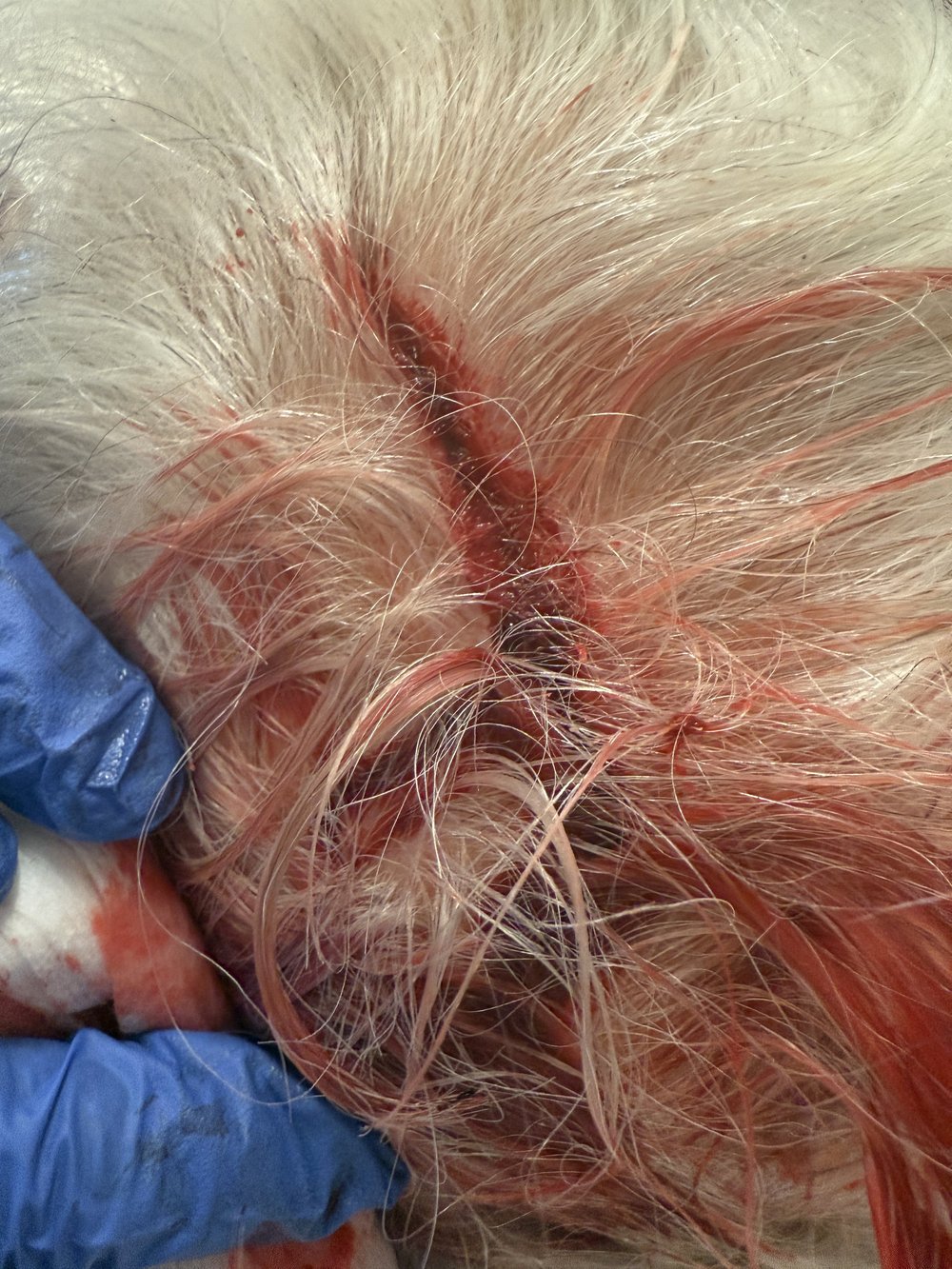 Scalp Laceration in Elderly Patient with Staple Closure — The Proceduralist