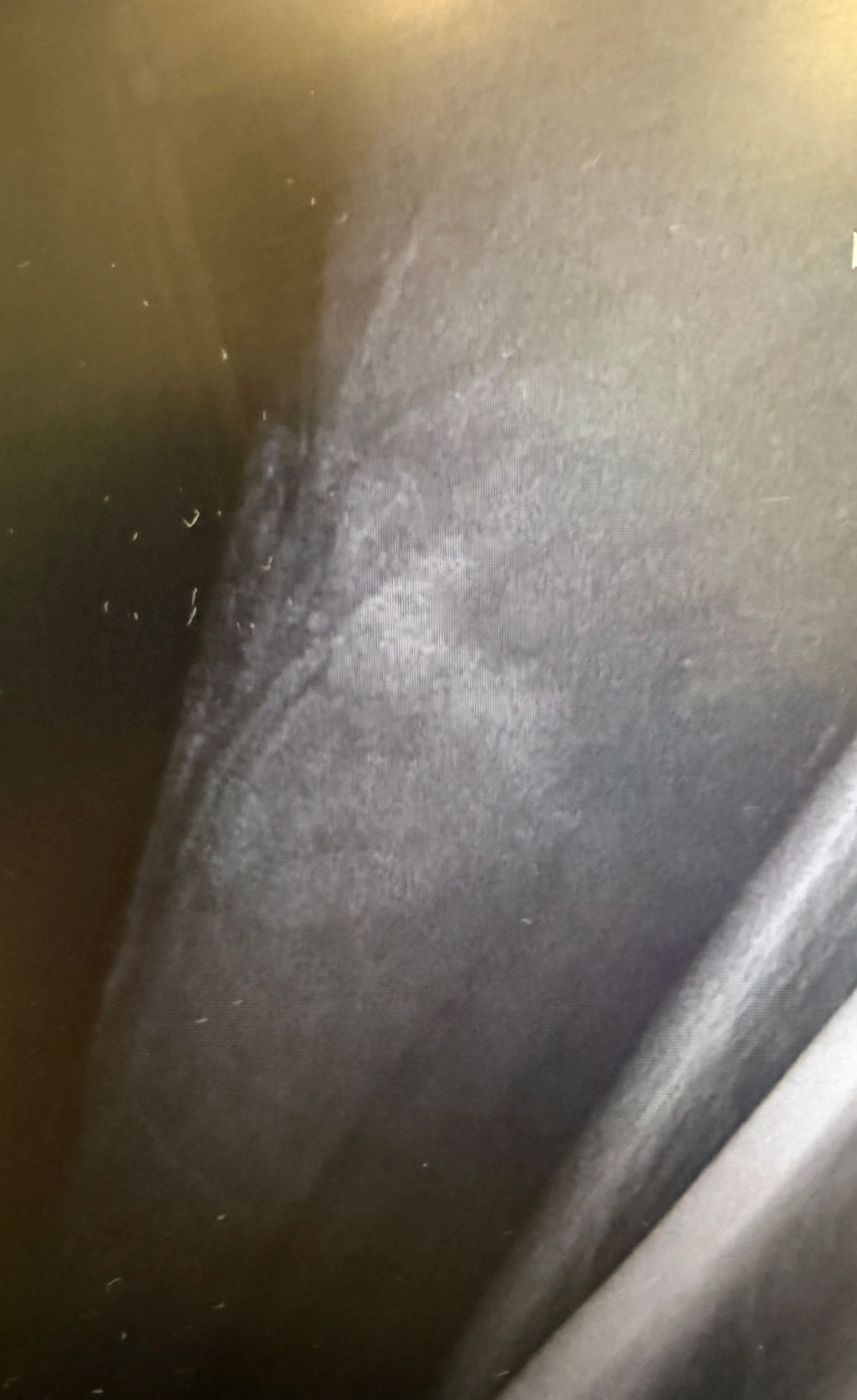 Lower Extremity Wounds and Flap Closure Techniques — The Proceduralist