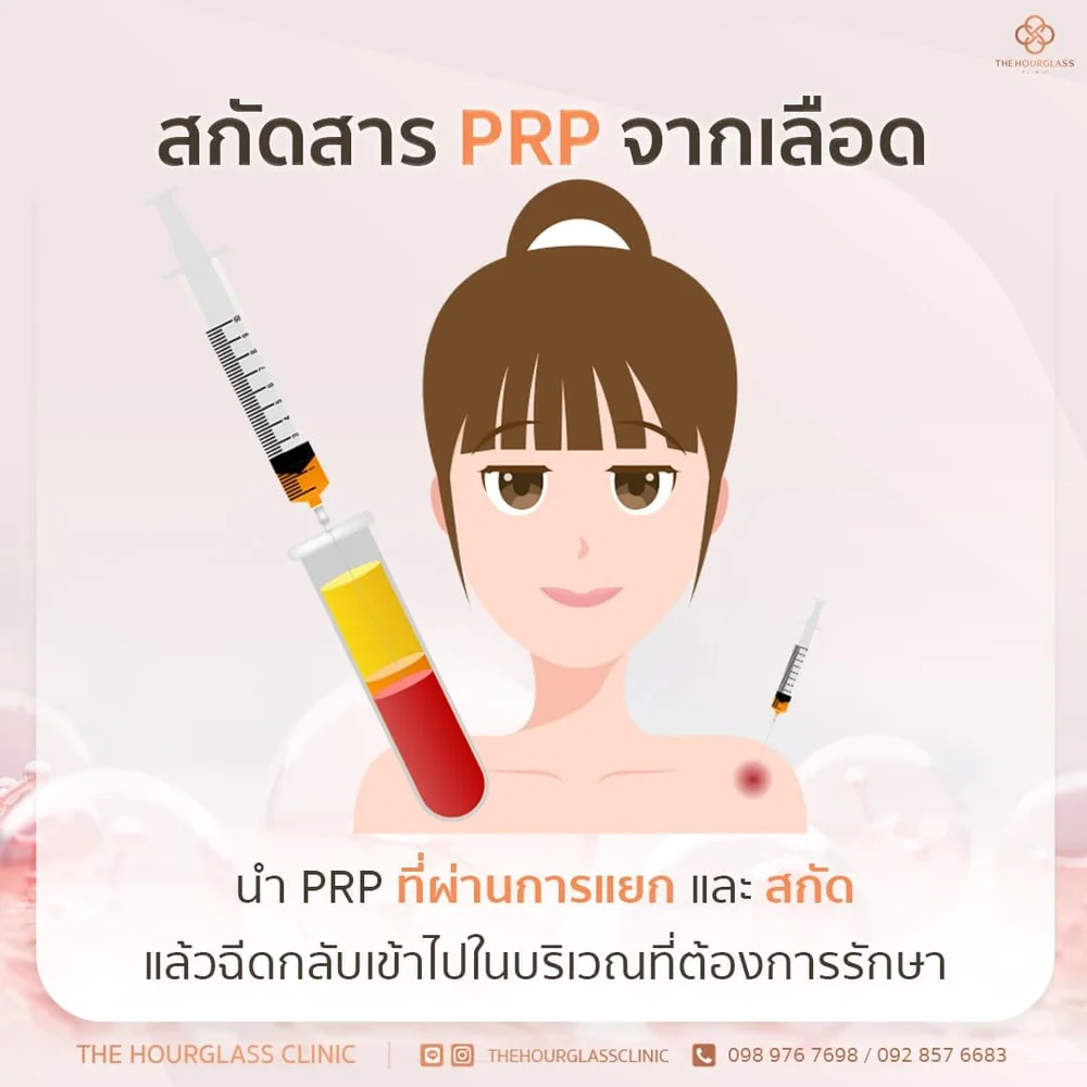 PRP (Platelet Rich Plasma) | ฟื้นฟูผิวหน้า ลดริ้วรอย กระตุ้นคอลลาเจน ...