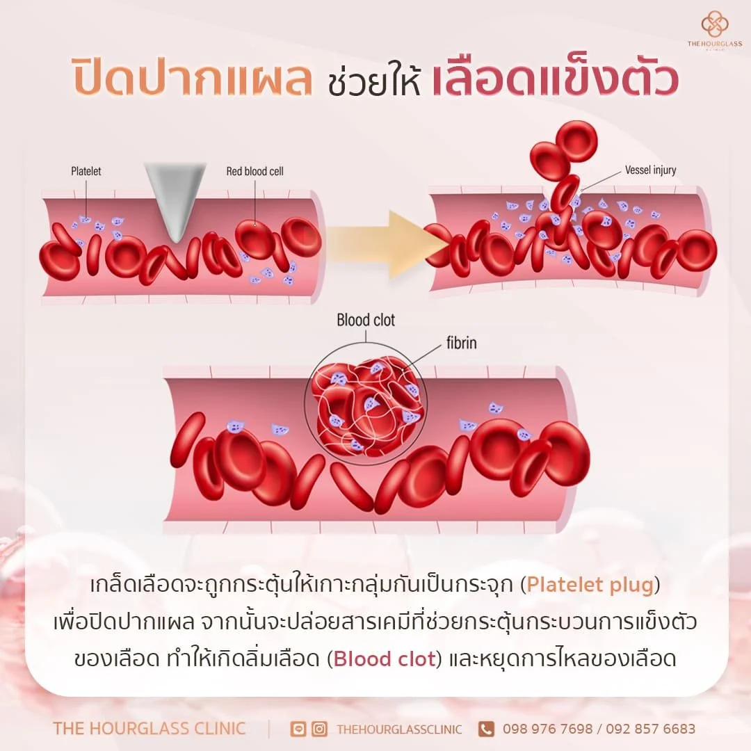 PRP (Platelet Rich Plasma) | ฟื้นฟูผิวหน้า ลดริ้วรอย กระตุ้นคอลลาเจน ...