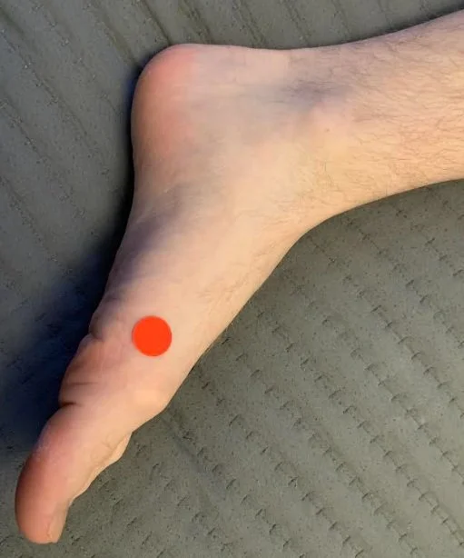 The Top Five (and One Secret) Acupuncture Points for Diabetes — St ...