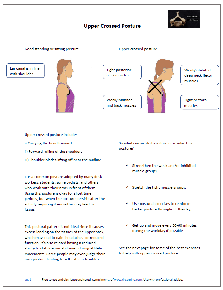 Upper crossed posture patient handout — DR. CARPINO