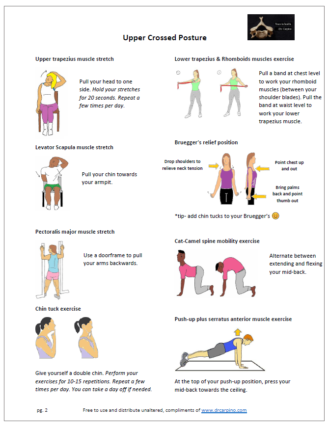 Upper crossed posture patient handout — DR. CARPINO
