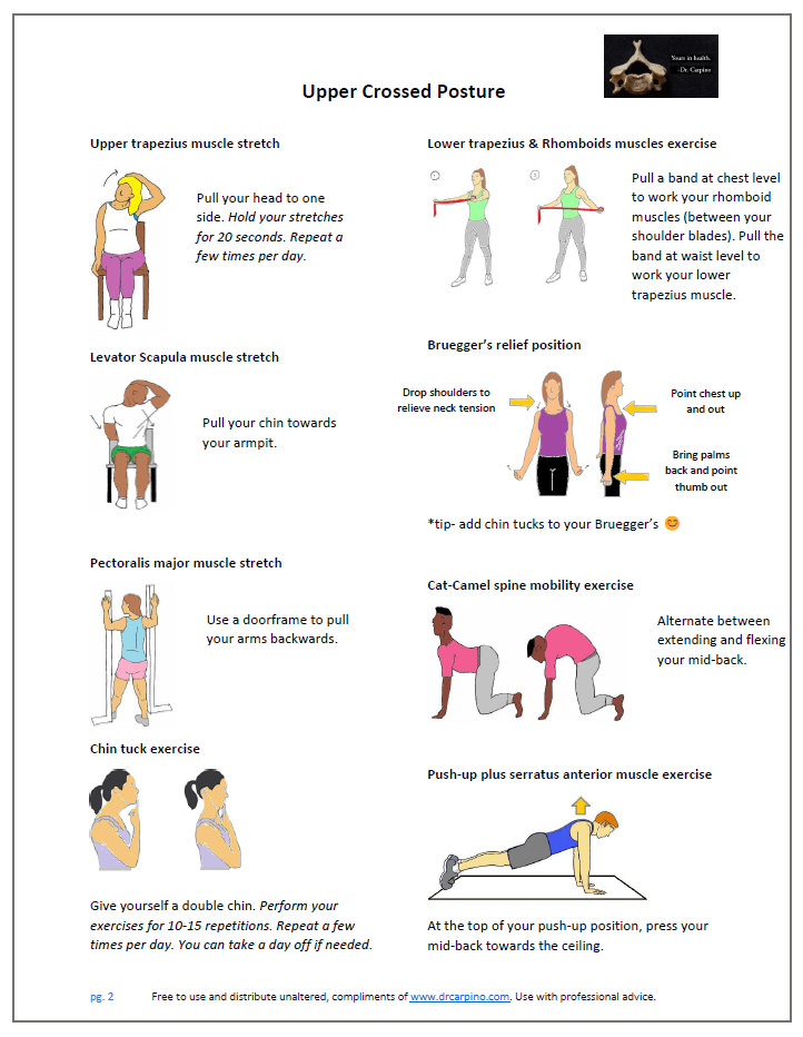 Upper crossed posture patient handout — DR. CARPINO