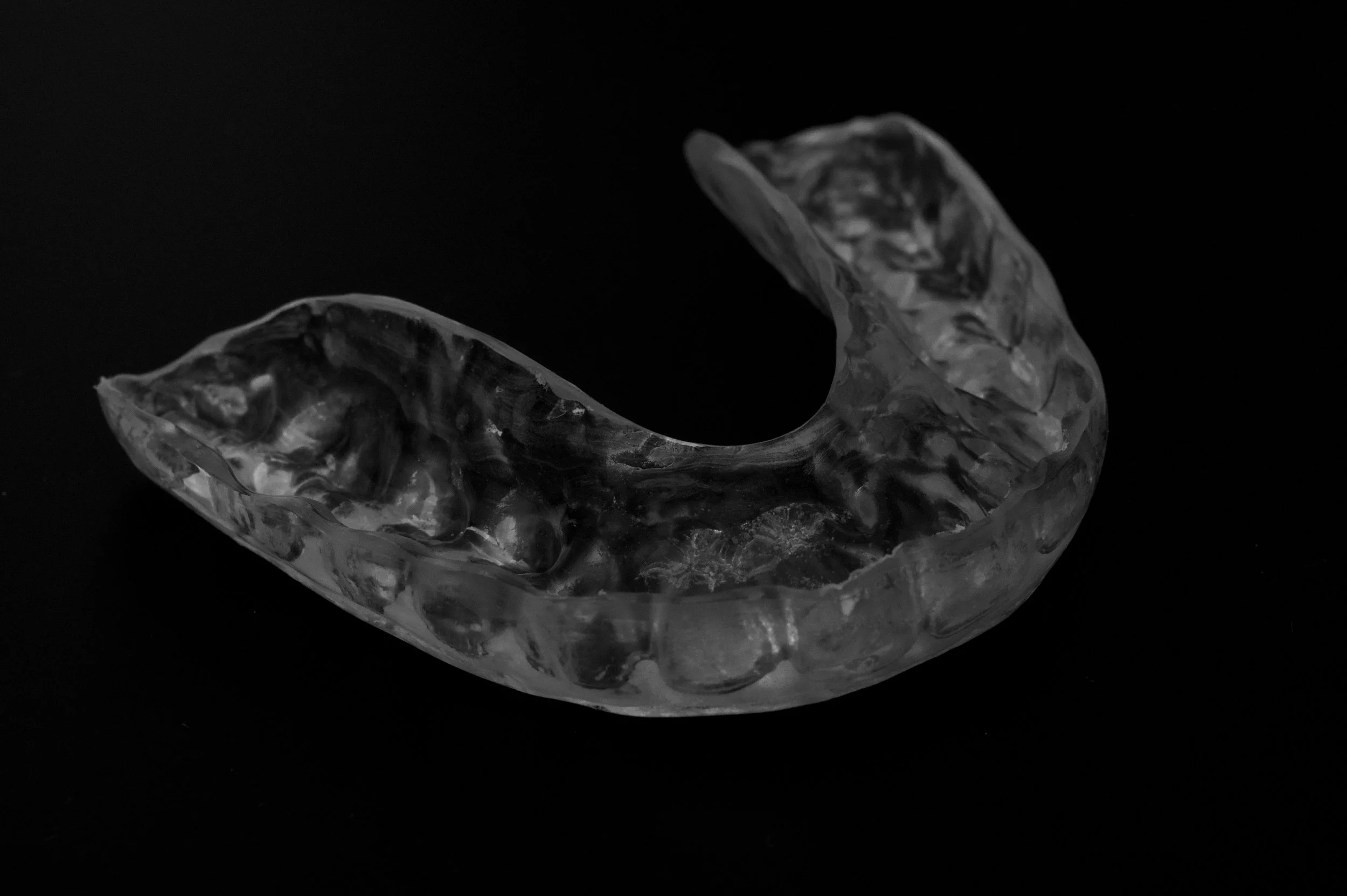 TMP i bruksizam — Nevea Dent - ordinacija dentalne medicine