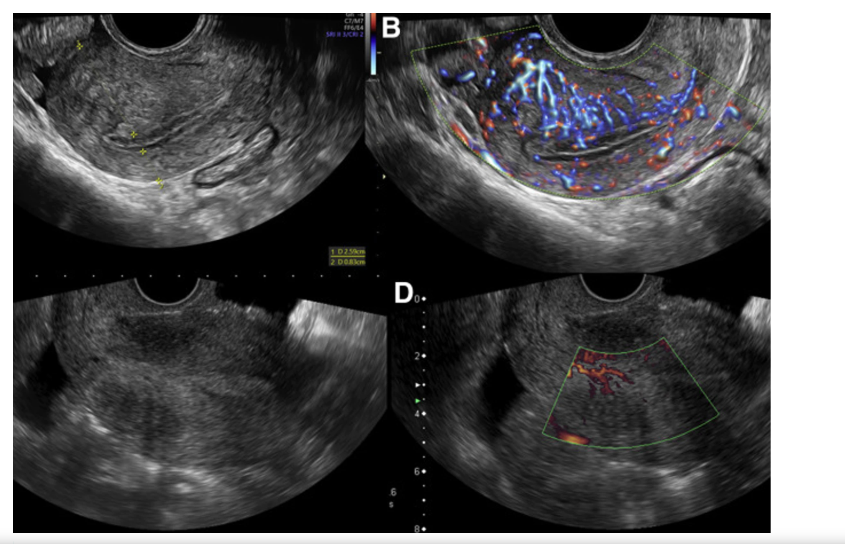 Reviews 1 — The GRACE Center