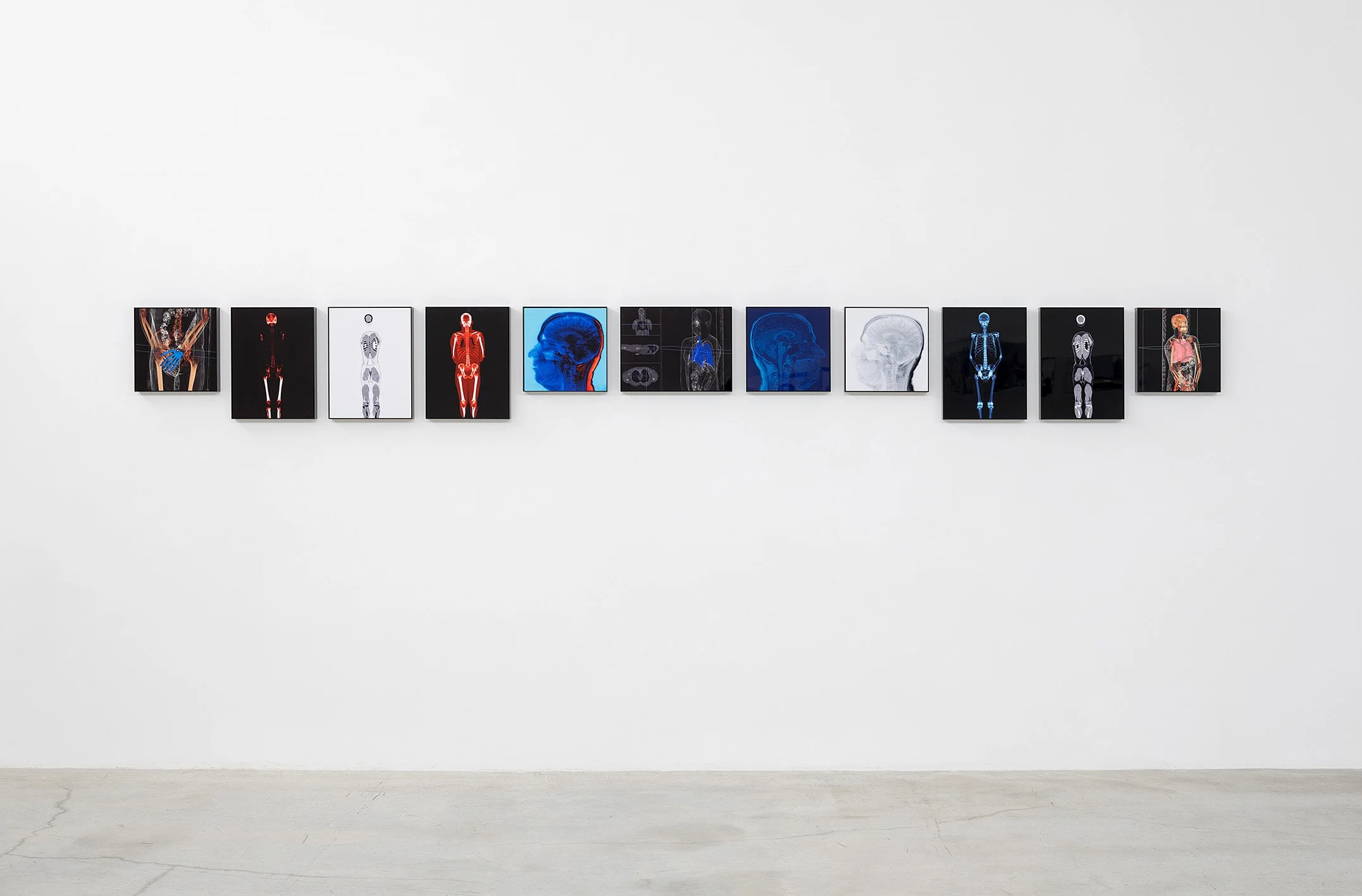 Body of Work | Itamar Gilboa — Alon Segev