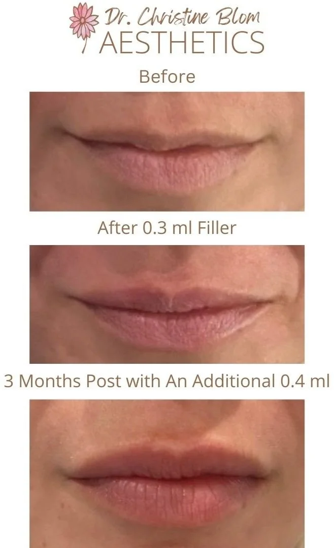 Services 4 — Dr. Christine Blom Aesthetics