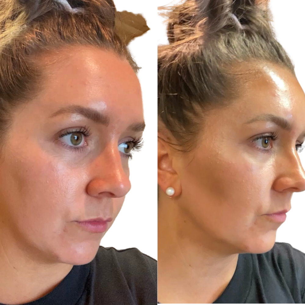Contouring 101 — The Confident Co.