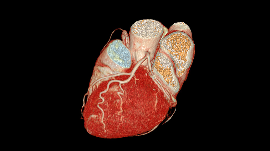 Cardiac CT for Radiographers — Radiology Retreats