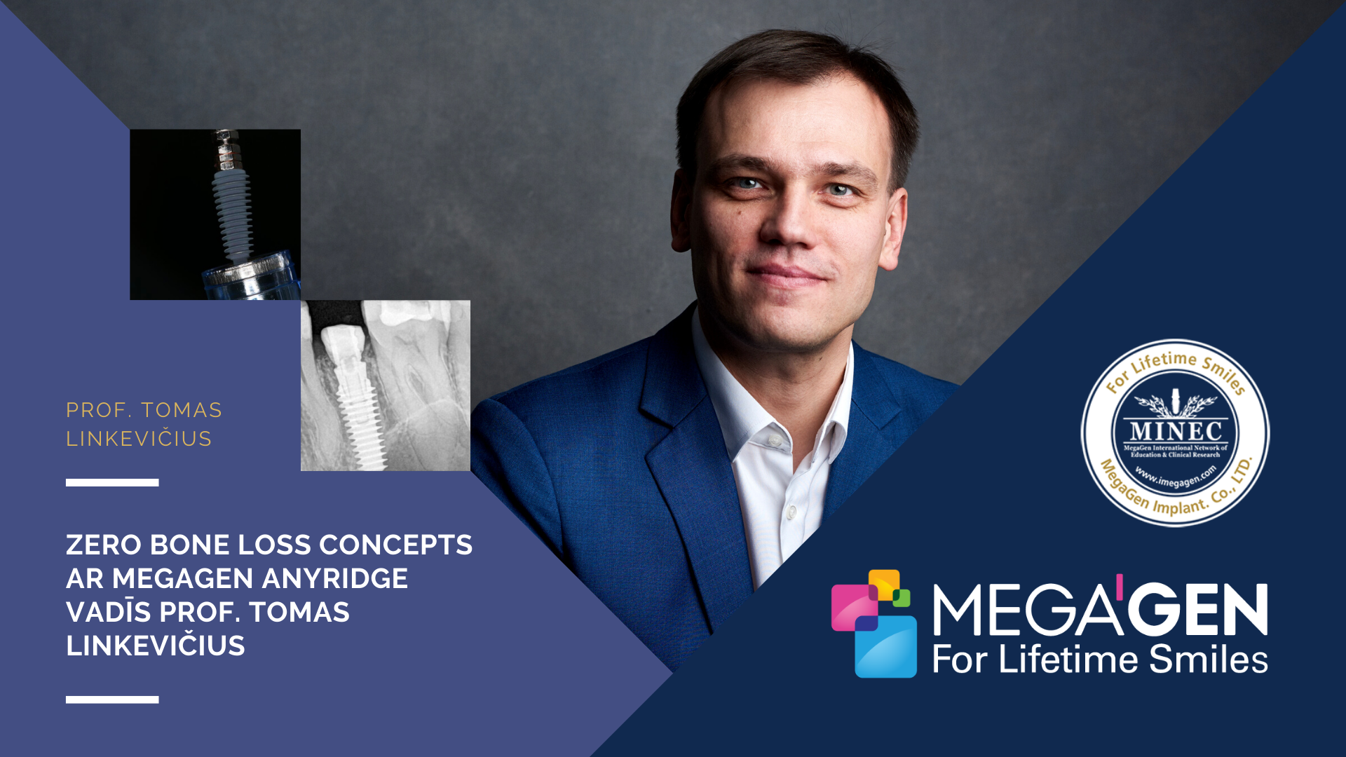 Zero Bone Loss Concepts ar MegaGen AnyRidge vadīs Prof. Tomas ...