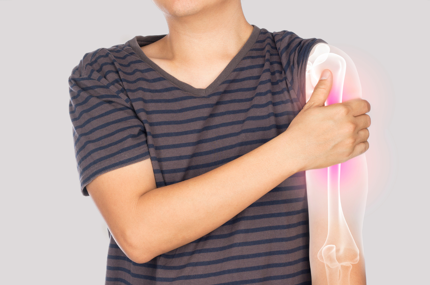 Dislocated Shoulder Cast