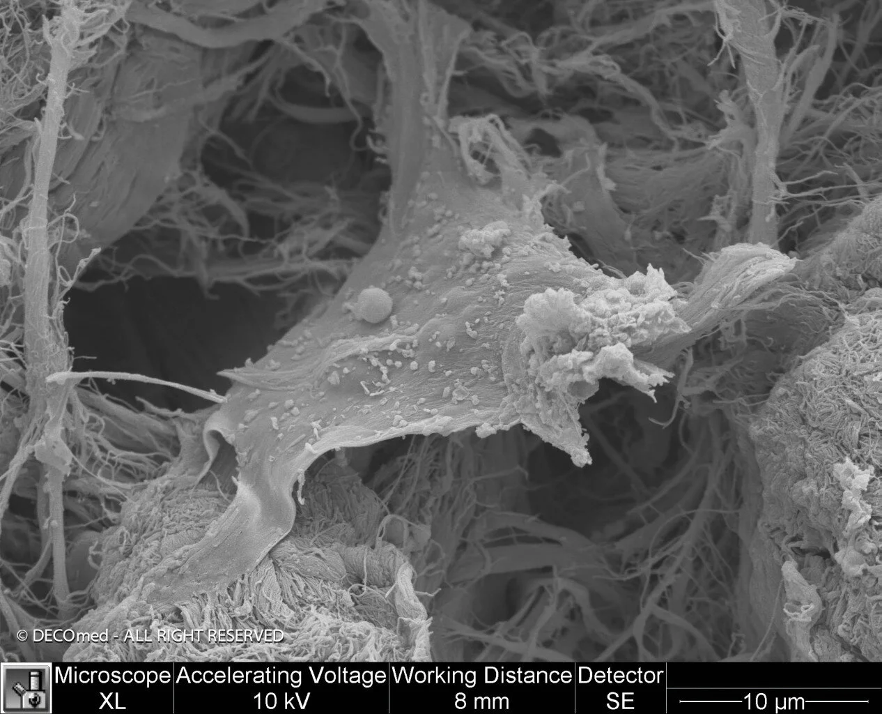 Braxon Fast ADM — Braxon Fast