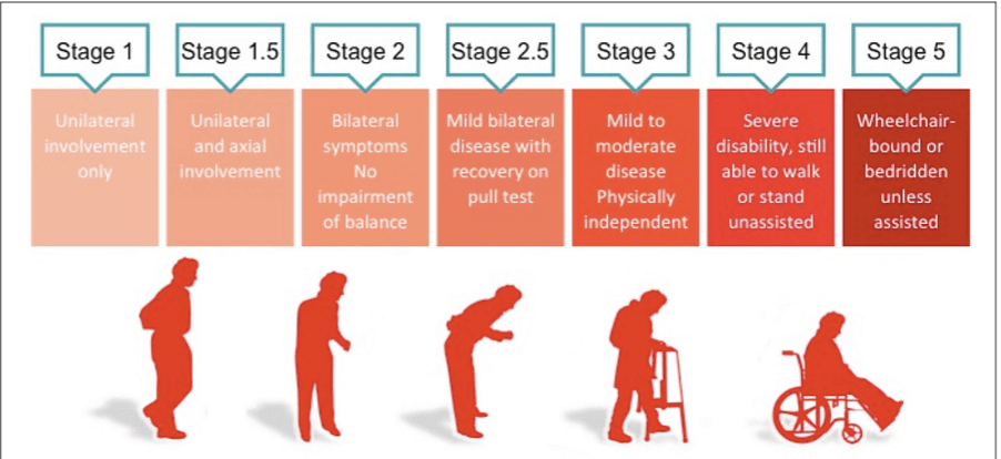Exercise prescription for Parkinson’s – how the little details make BIG ...