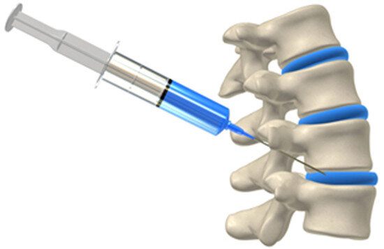 AXIS SPINE AND ORTHOPEDICS
